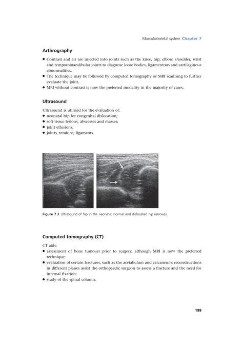 Radiology Lecture Notes Pdf 67 Musculoskeletal System Chapter 7 199 Arthrography Contrast