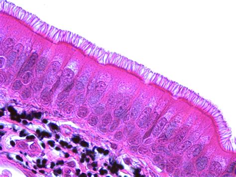 Simple Ciliated Columnar Epithelium
