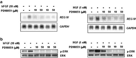 Expression Of The Reg Iv Gene In Ulcerative Colitis Laboratory