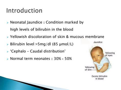 Neonatal Jaundice Cpg Pptx