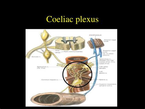 Ppt Coeliac Plexus Block Powerpoint Presentation Id2016538