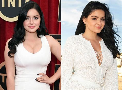 Celebrities Who Opted For Breast Reduction A Bold Choice