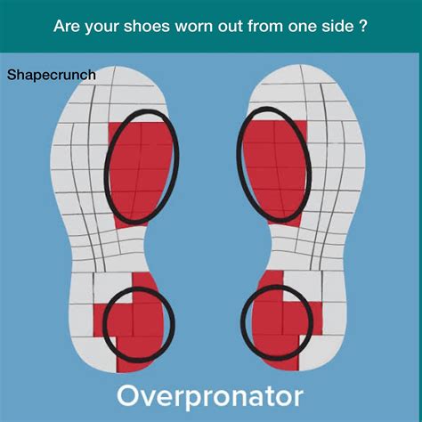 Why Do My Shoe Soles Wear On One Side