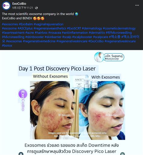 什麼是外泌體 Exosomes ？對皮膚有何神奇功效？ 林政賢皮膚科診所