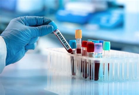 10 симптомов краснухи у взрослых как проявляются симптомы краснухи и что надо делать в домашних