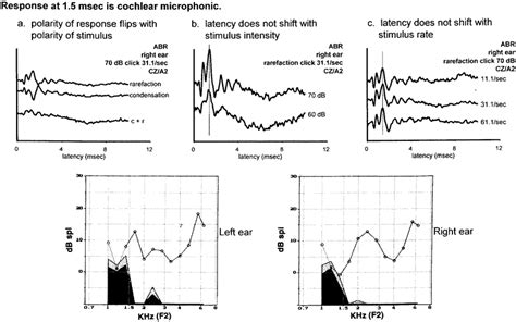 Top The Three Panels Illustrate The Absence Of Abr Waves The