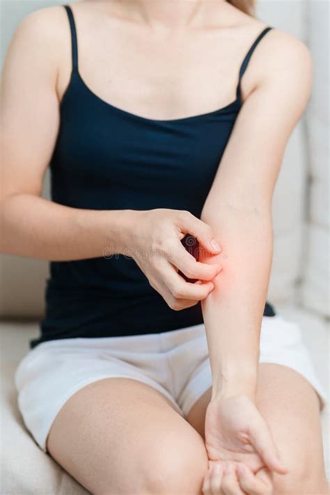 Woman Itching And Scratching Itchy Arm Sensitive Skin Allergic