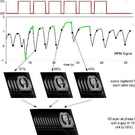 4d Ct Imaging Reconstruction Process Of A 3d Ct Image At A Discrete