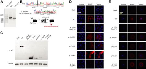 Effects Of The Lof Variants On Nuclear Localization In Hela Cells And