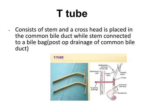 Most Common Drains Used In General Surgery Ppt