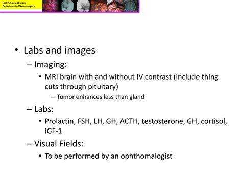 Ppt Pituitary Tumors Powerpoint Presentation Free Download Id5573943