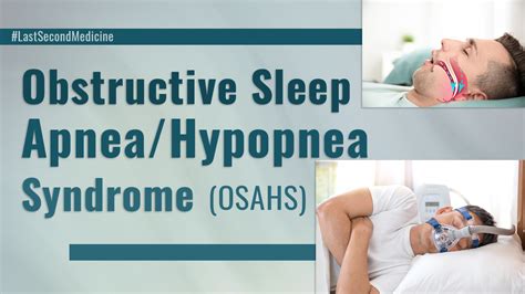 Obstructive Sleep Apnea Hypopnea Syndrome An Easy Overview Medical