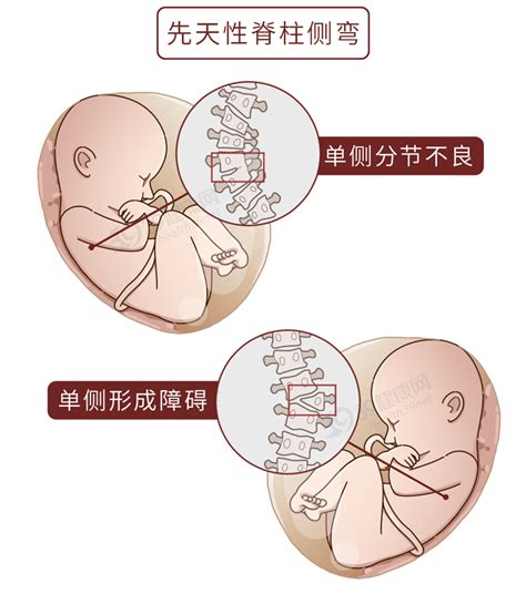 别再只是“把背挺直”了！正确的坐姿是这样的，许多人还不知道