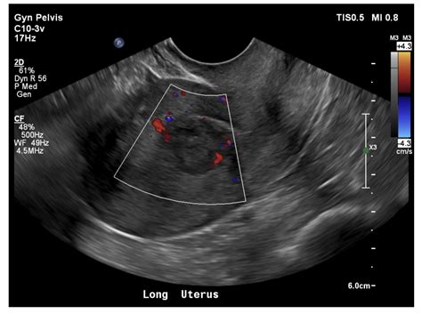 Mystery Lesion R Askdocs
