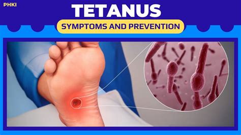 Tetanus Causes Symptoms And Prevention Youtube