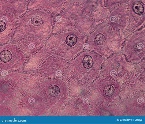 Epidermis Spinous Cell Layer Stock Image Image Of Histology Epithelial 231124691