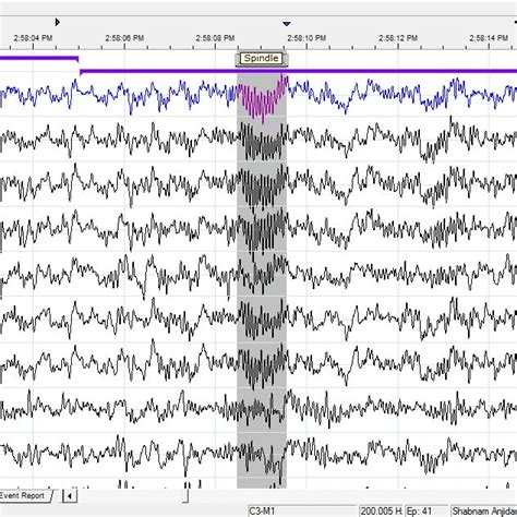 Pdf Sleep Spindle Detection And Prediction Using A Mixture Of Time