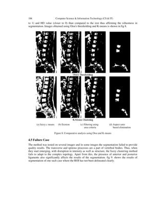 SEGMENTATION AND LABELLING OF HUMAN SPINE MR IMAGES USING FUZZY CLUSTERING PDF