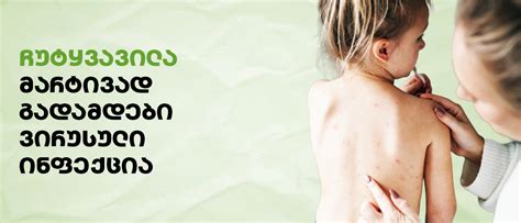 Psp Ge ონლაინ აფთიაქი