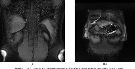Figure 4 From Biij Biomedical Imaging And Intervention Journal The