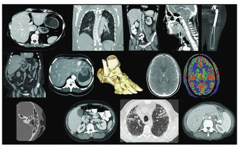 Computed Tomography Radiology Key