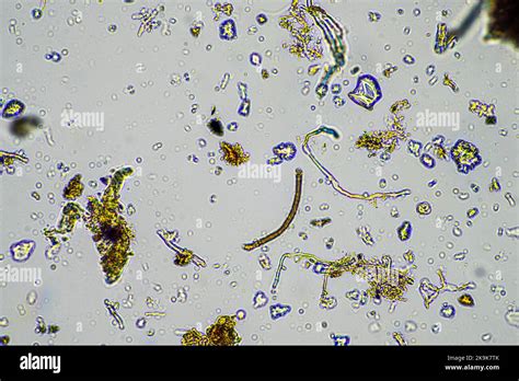 Hyphae Of Fungi Microscope