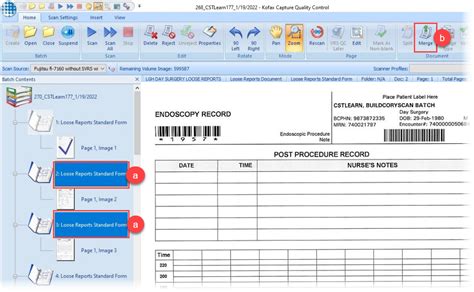 Perform Quality Control In Kofax Capture Batch Scanning Him