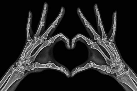 An X Ray Image Of Two Hands Making A Heart Shape