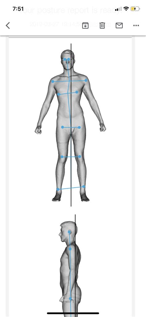 Took A 3d Posture Analysis What Can I Do To Help Correct This R