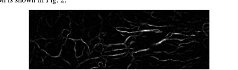 Filtered Image Using The Multiscale Iterative Algorithm Download