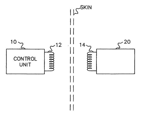 Transmission Line Coupling Arrangements Patented Technology Retrieval Search Results Eureka
