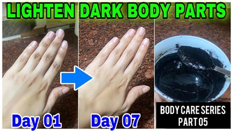 Lighten Your Private And Dark Body Parts In Just Days Dark Private Parts Whitening Remedy