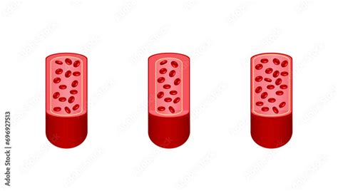Arterial Vasoconstriction And Vasodilation Cross Section Of Arteries