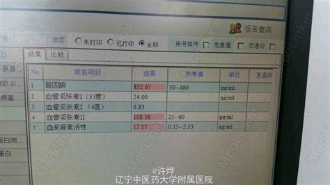 Gitelman综合征 医联