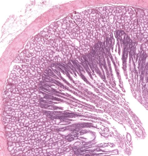 Small Intestine Duodenum Diagram Quizlet
