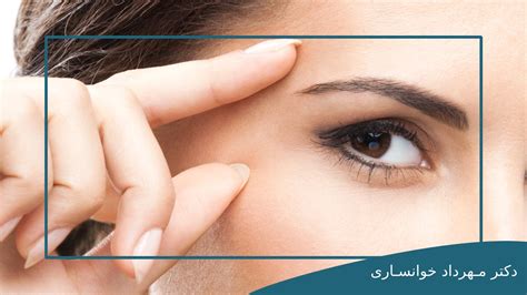 ورزش افتادگی پلک راهی برای پیشگیری و درمان افتادگی پلک مجله چشم پزشکی