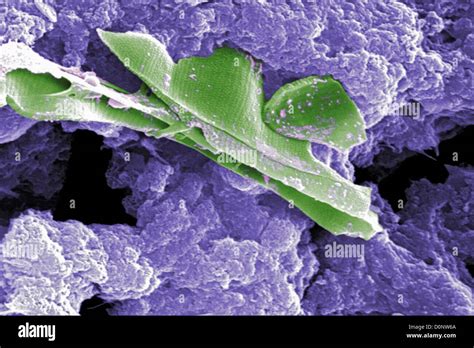 This Digitally Colorized Scanning Electron Micrograph SEM Untreated Water Specimen Extracted