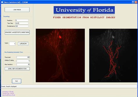 A Gui Is Implemented Which Handles The Segmentation Of The Fibers Also Download Scientific