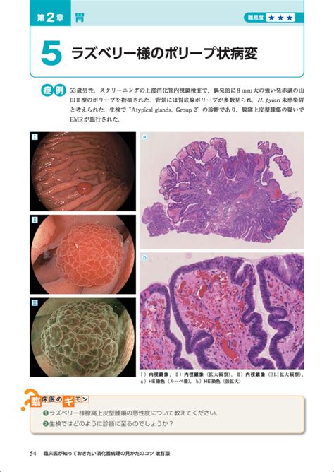 臨床医が知っておきたい消化器病理の見かたのコツ 改訂版 羊土社