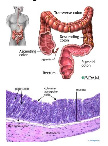 Diseases Of The Large Intestine And Appendix Flashcards Quizlet