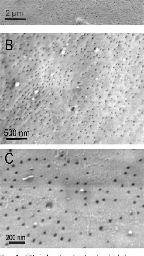 Figure 1 From Cell Surface Orifices Of Caveolae And Localization Of