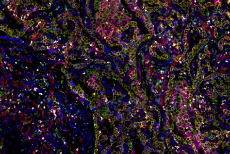 多重荧光免疫组化 Tsa技术 知乎