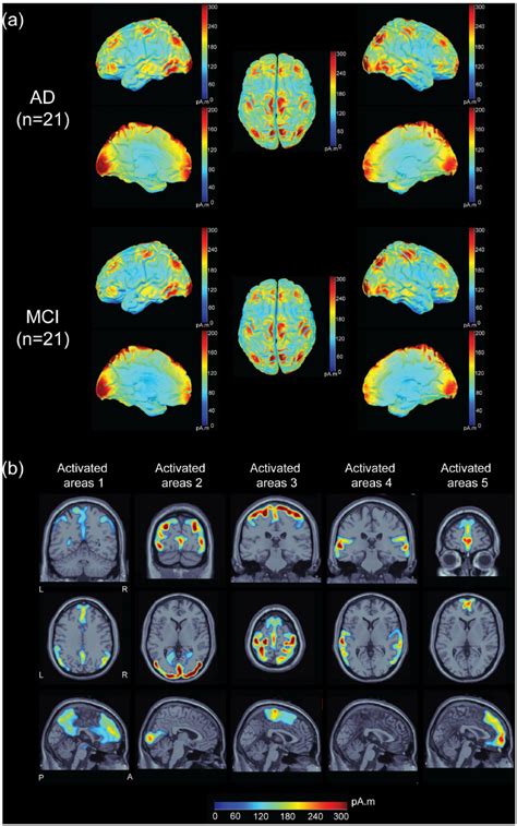 Resting State Networks From Eeg Data A Distributions Of Averaged