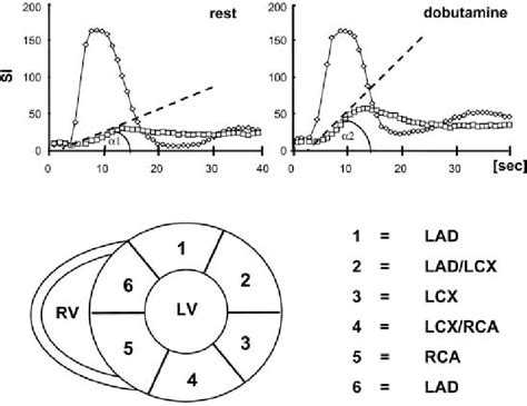 The Six Evaluated Myocardial Segments Of The Left Ventricular Download Scientific Diagram