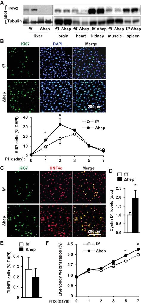 Hepatic NF KB Inducing Kinase NIK Suppresses Mouse Liver Regeneration In Acute And Chronic