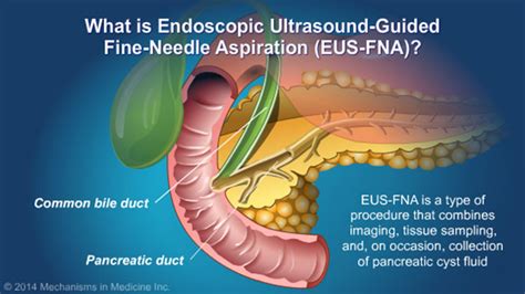Slide Show Understanding Eus Fna