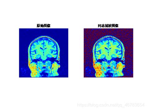 同态滤波器原理及其数字图像处理算法实现 Csdn博客 同态滤波器原理及其数字图像处理算法实现 Csdn博客
