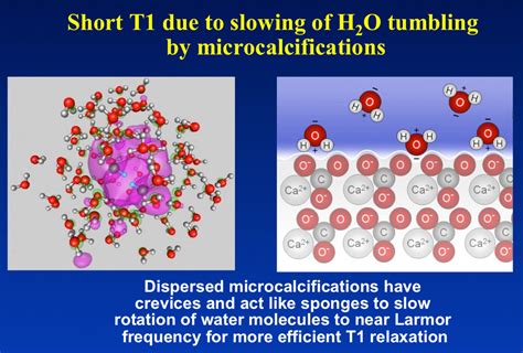 Short T1 Calcification Questions And Answers In Mri