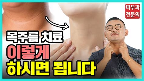 청담 피부과원장의 목주름 유형별 꼭 하는 시술 5가지 Youtube