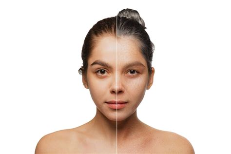 Anti Ageing Treatment At Nyraa Clinic Skin Tightening Bangalore